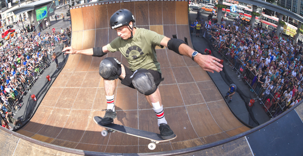 LOOK: Tony Hawk shares x-rays from gruesome hand injury