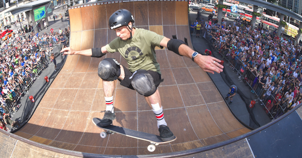 LOOK: Tony Hawk shares x-rays from gruesome hand injury