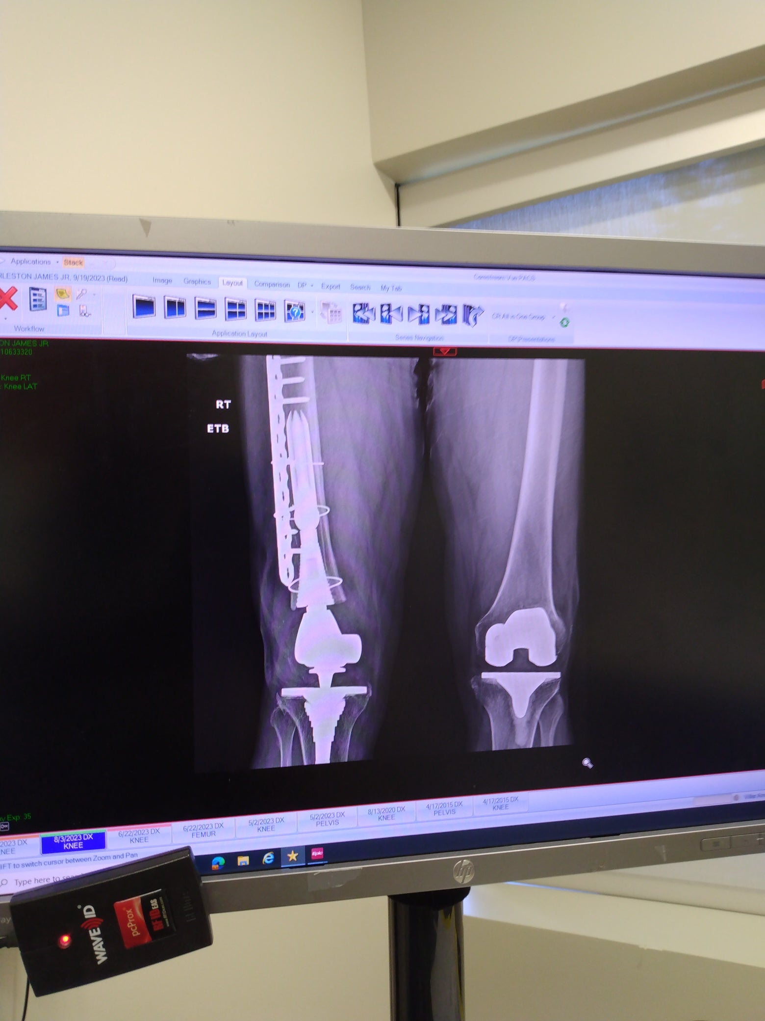 Ok. Gimme your orthopedic knee specialist