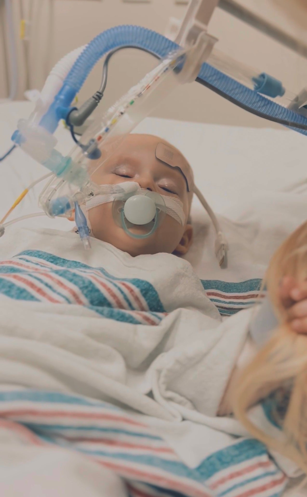 Graham is Doing Great! | Sons Heart Surgery Today