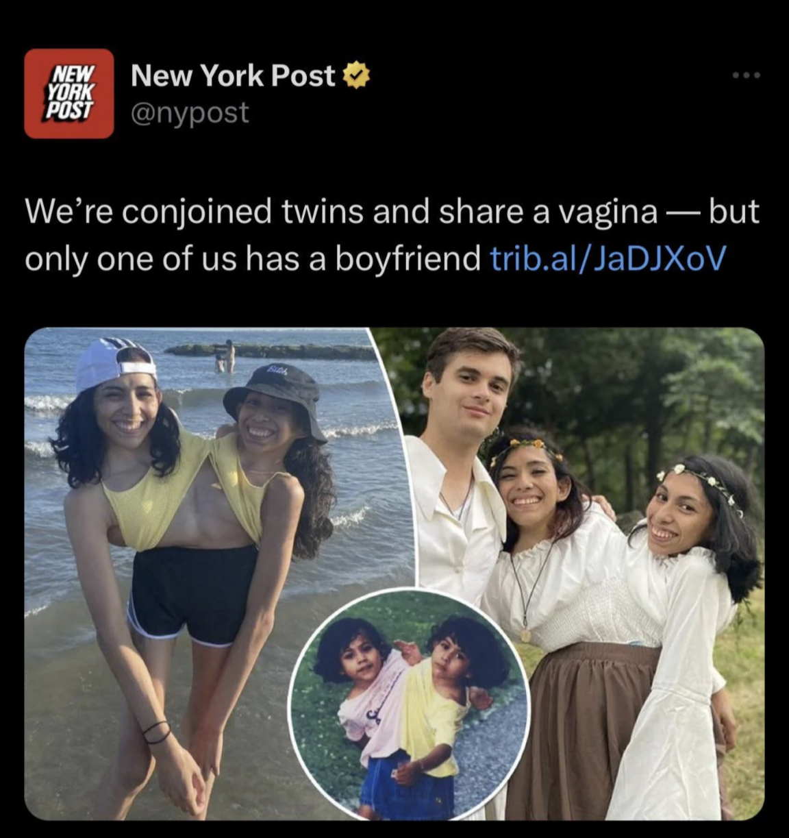 Conjoined Twins--Wood You?