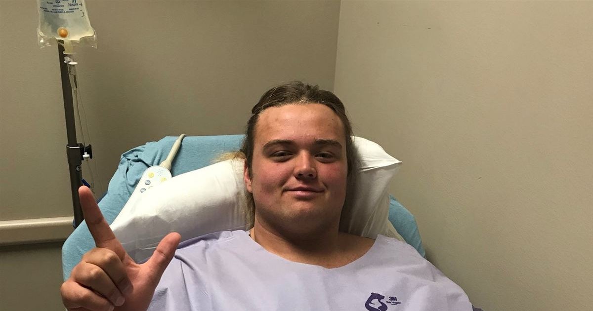 Add Jacob Farrell to the List of Fall Camp Injuries (Surgeries)