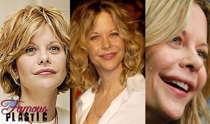 Biggest Celebrity butterfaces