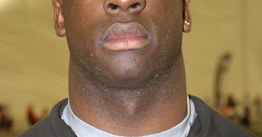 Singleton pledges to Nebraska